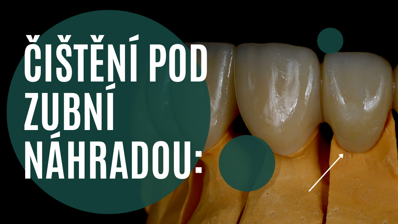 Čištění pod zubní náhradou | Stream