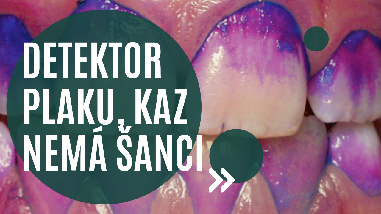 Detektor zubního plaku | Stream